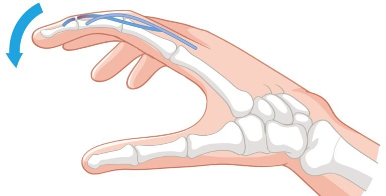 Hand Surgery in Turkey - Uncalı Hospital